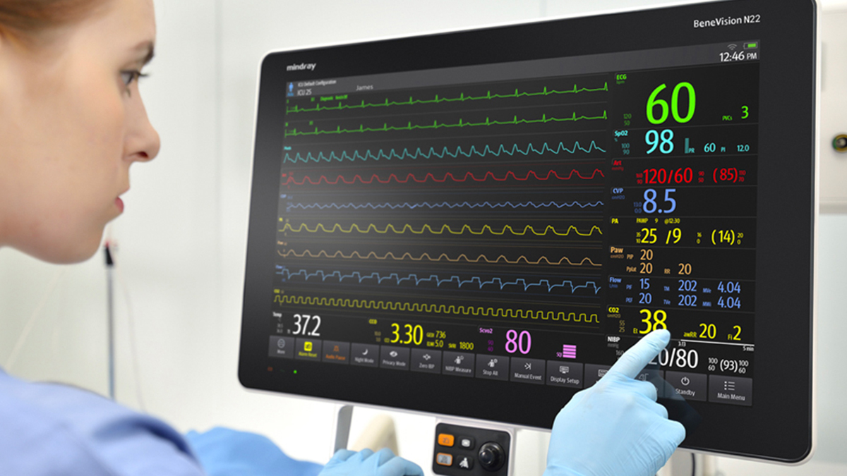 Monitorização Hemodinâmica Entenda Como é Utilizada Para Diagnóstico