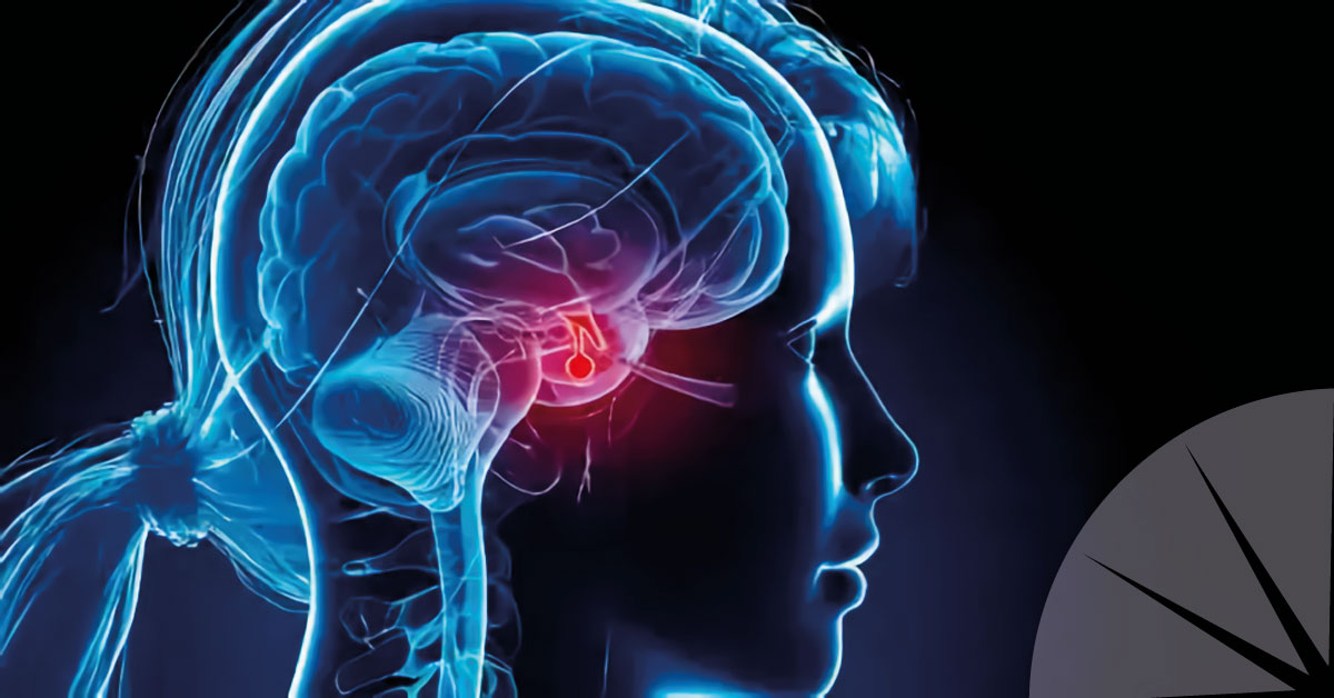 Cuáles Son Las Causas De Los Trastornos De Hipófisis Gamma Knife