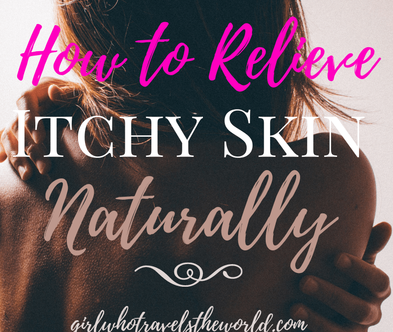 How To Relieve Itchy Skin Naturally Girl Who Travels The World