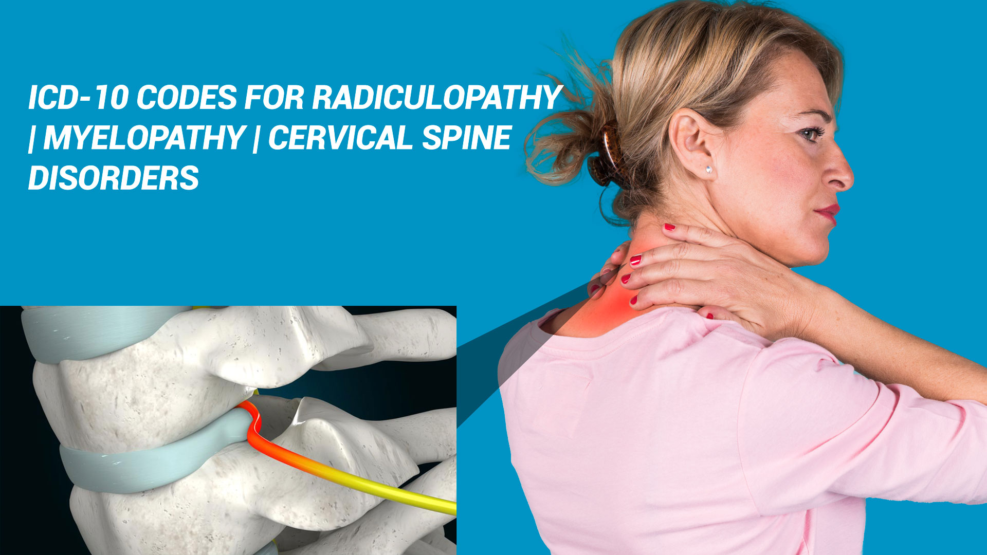 Icd 10 Codes For Radiculopathy Myelopathy Cervical Spine Disorders