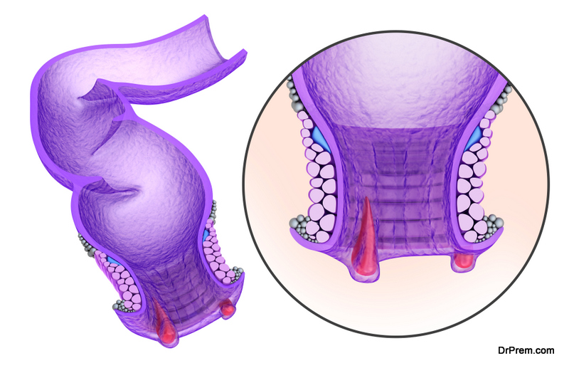 7 Best Exercises Encourage Healing Anal Fissure