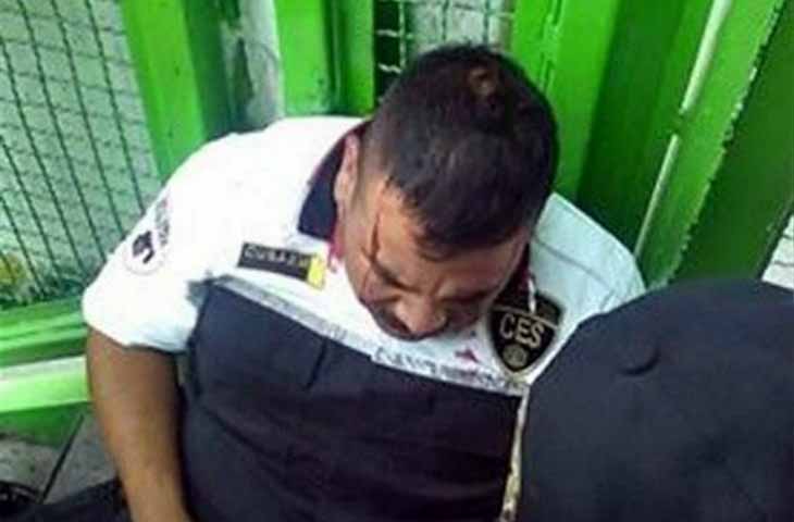 Agreden A Policías En Edomex Uno Fue En Naucalpan