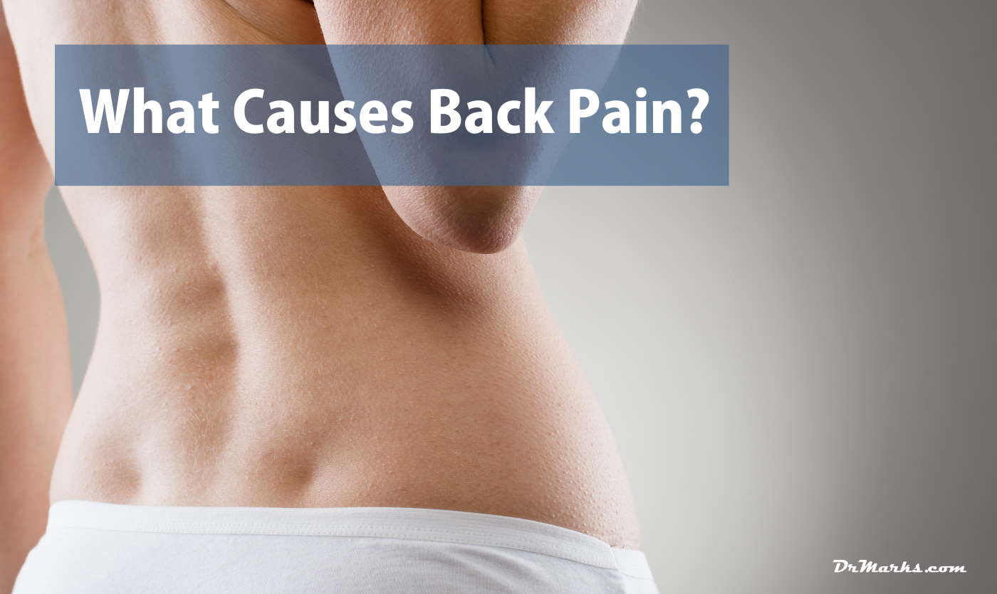 What Causes Back Pain Chiropractor Orange Ca