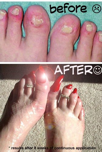 Perfect Nails Made Easy 8 Feet In 8 Weeks