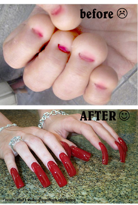 Perfect Nails Made Easy 8 Feet In 8 Weeks Emtoast