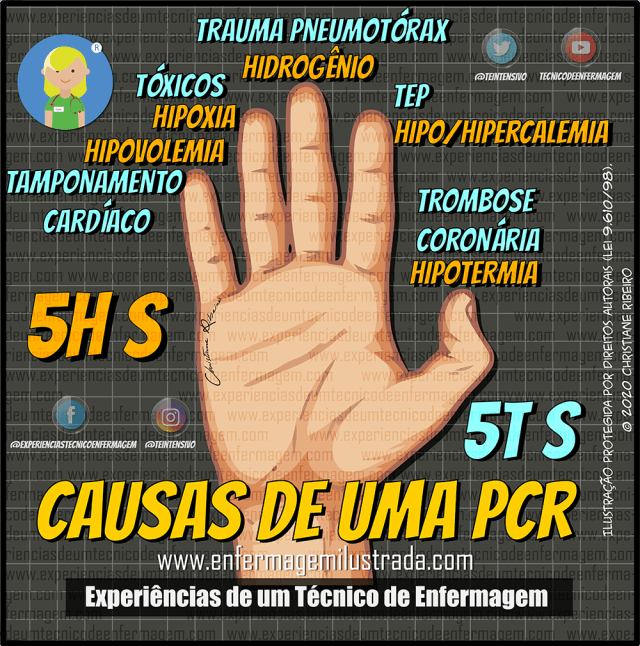 Parada Cardiorrespiratória Os 5h´s E 5t´s Das Possíveis Causas