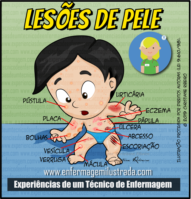 Conheça Os Tipos De Lesões De Pele Cutâneas Enfermagem Ilustrada