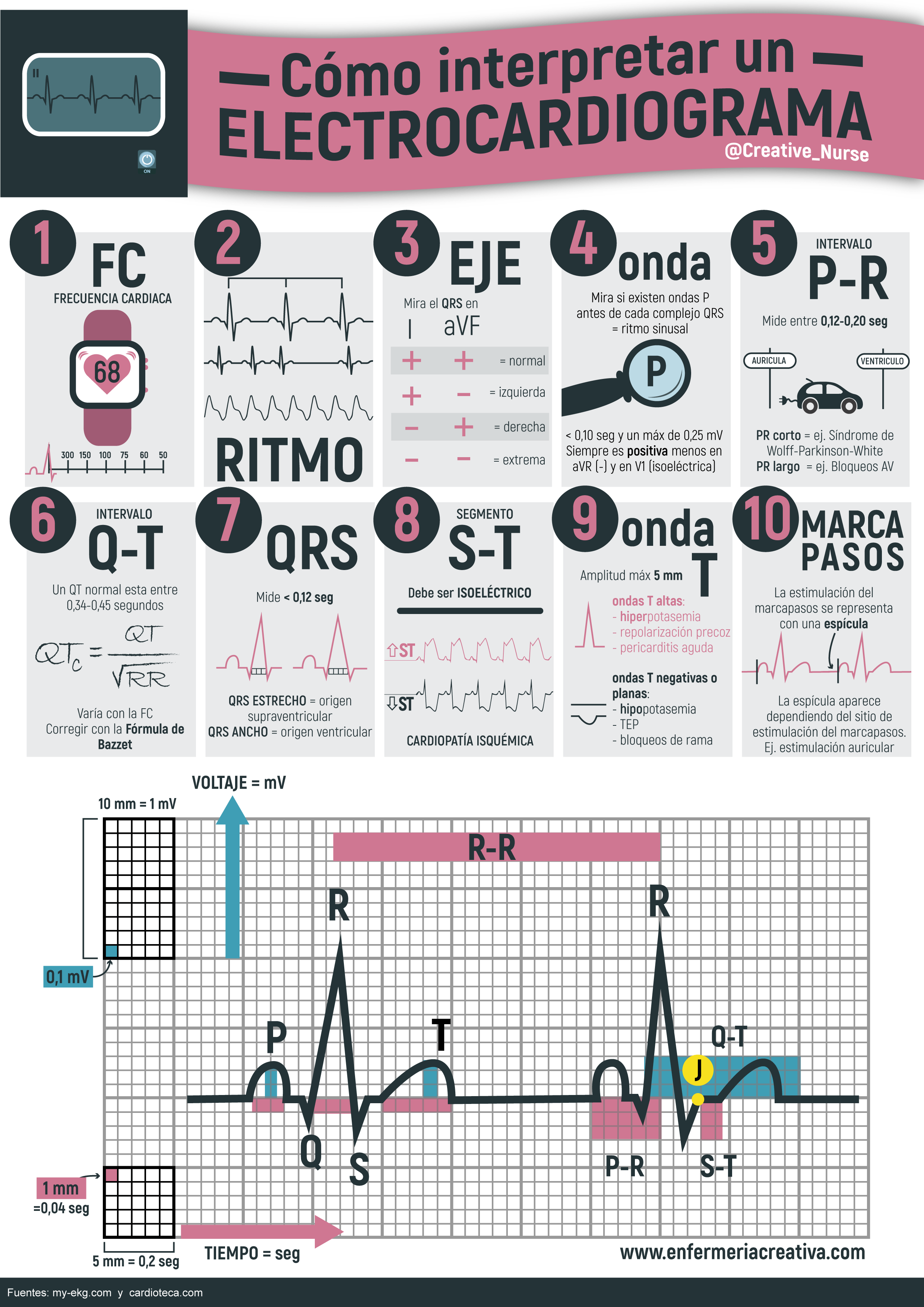 Eletrocardiograma Ecg Entenda Como Funciona E Como Analisar Porn Sex