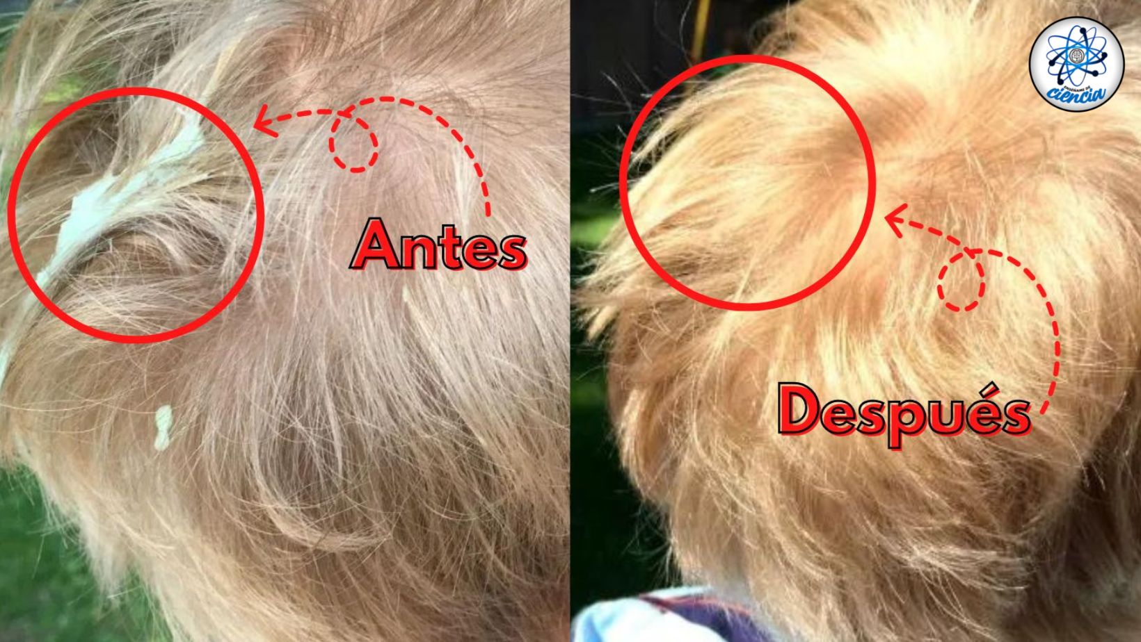 Cómo Quitar Un Chicle Pegado En El Cabello El Truco Definitivo Sin