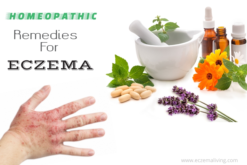 Homeopathy For Eczema Best 7 Eczema Homeopathic Remedies
