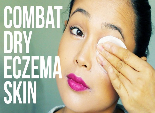 Eczema Friendly Makeup And Beauty Tips For Women