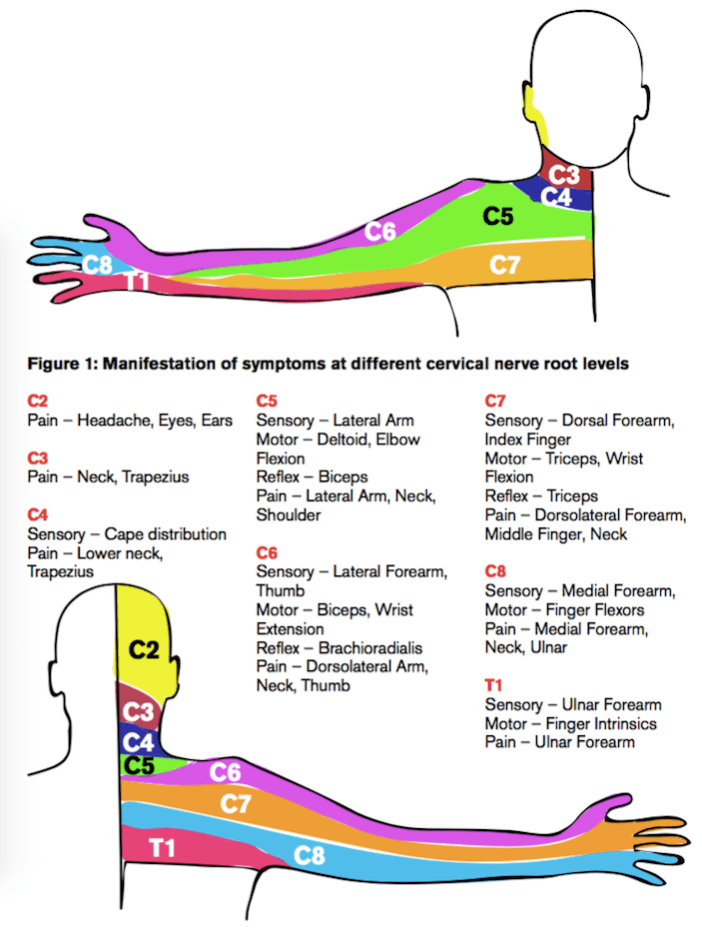 Cervical Radiculopathy Emergency Physicians Monthly