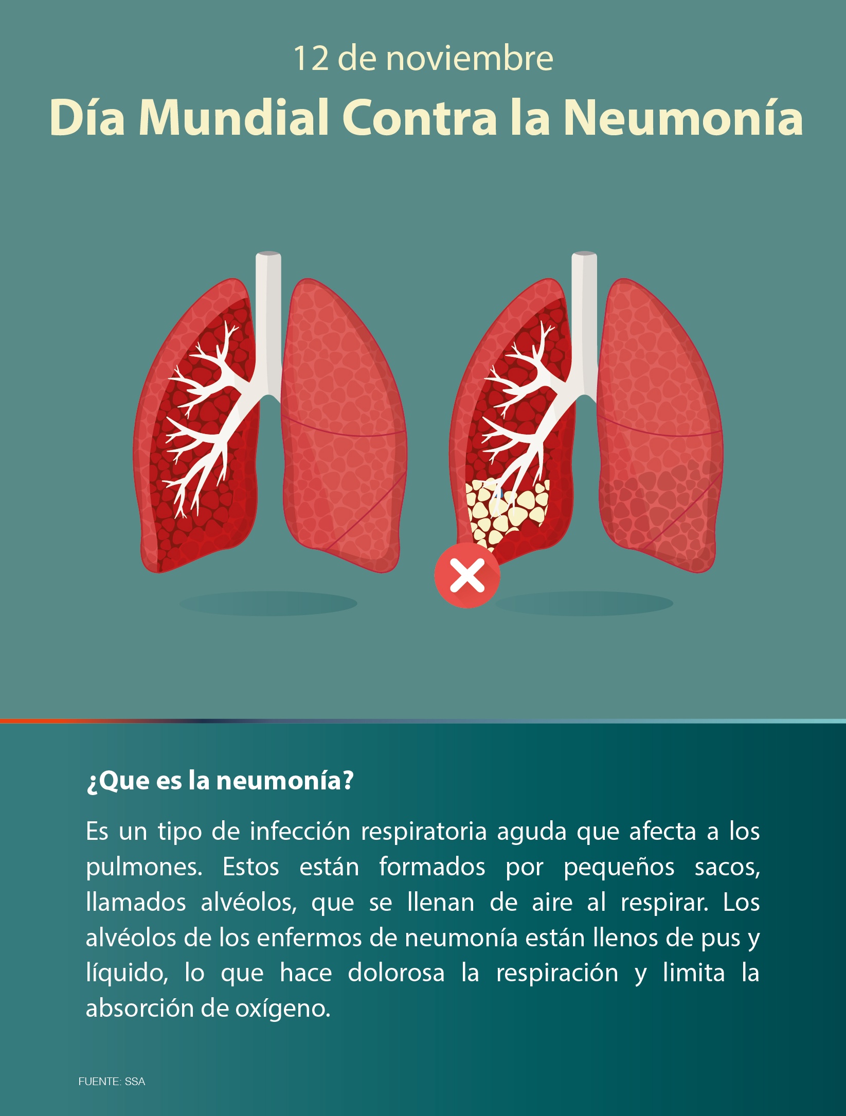 12 De Noviembre Día Mundial Para La Prevención De La Neumonía