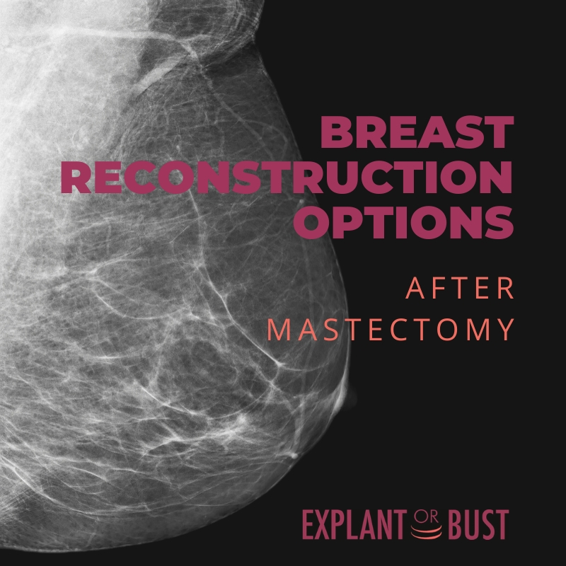 Breast Reconstruction Options After Mastectomy Explant Or Bust