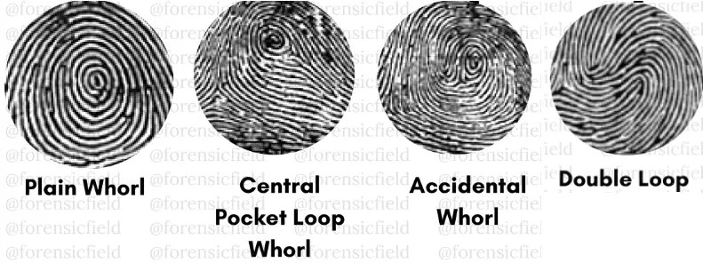 Types Of Fingerprint Patterns Forensics Blog