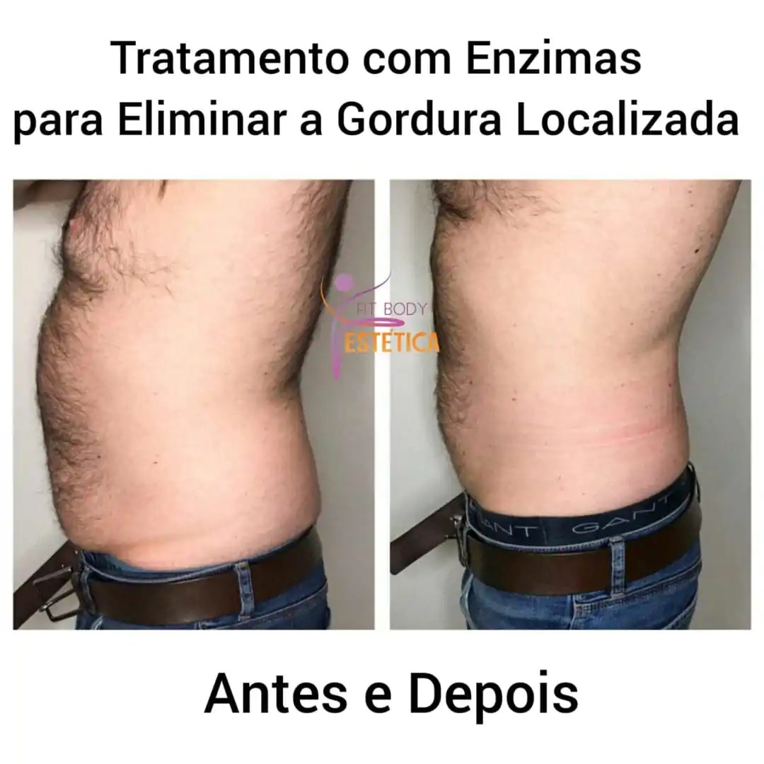 O Que Fazer Para Eliminar A Gordura Localizada Fit Body Estética