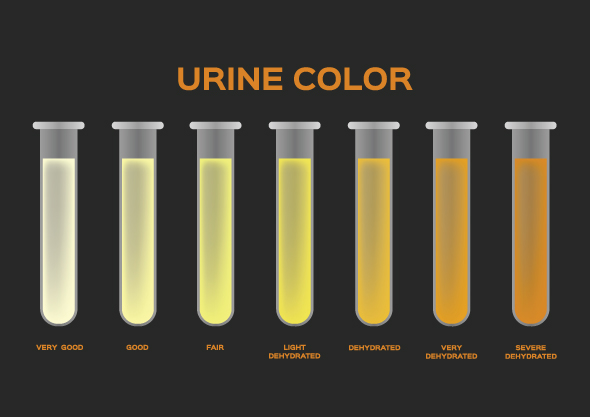 Is The Color Of Your Urine A Sign Of Dehydration Karen Sutton Md