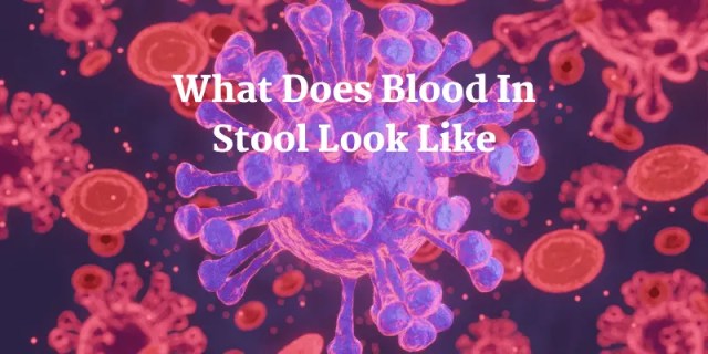 What Does Blood In Stool Look Like Heal My Hemorrhoids