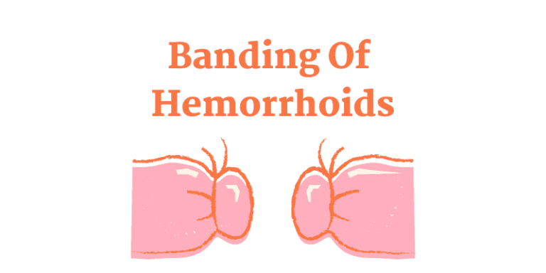 Banding Of Hemorrhoids Heal My Hemorrhoids