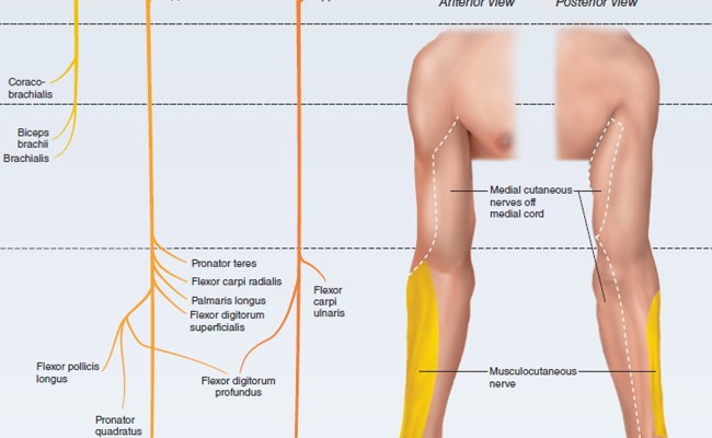 Upper Extremity Nerve Injuries Boredmonday