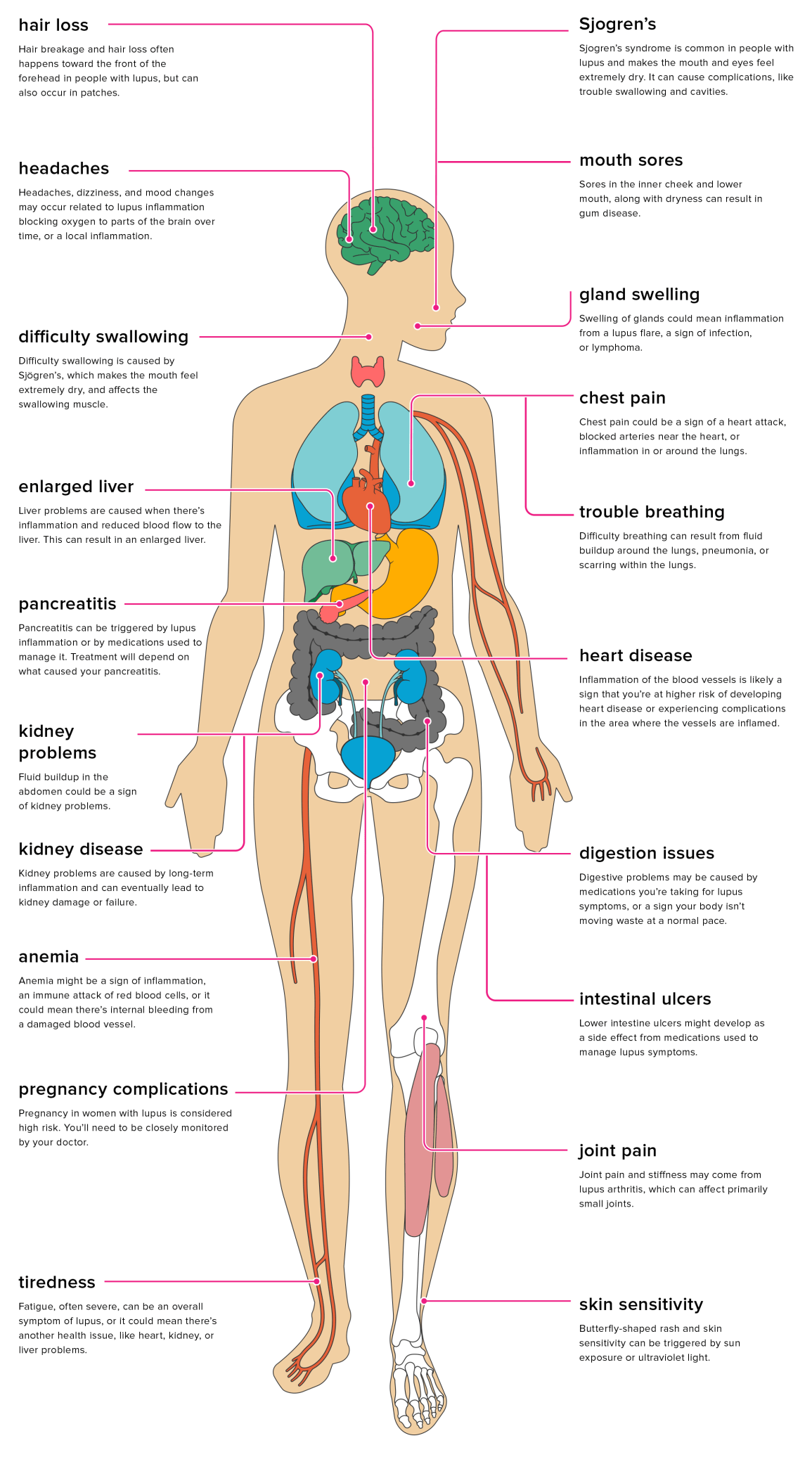 How Does Lupus Affect The Body