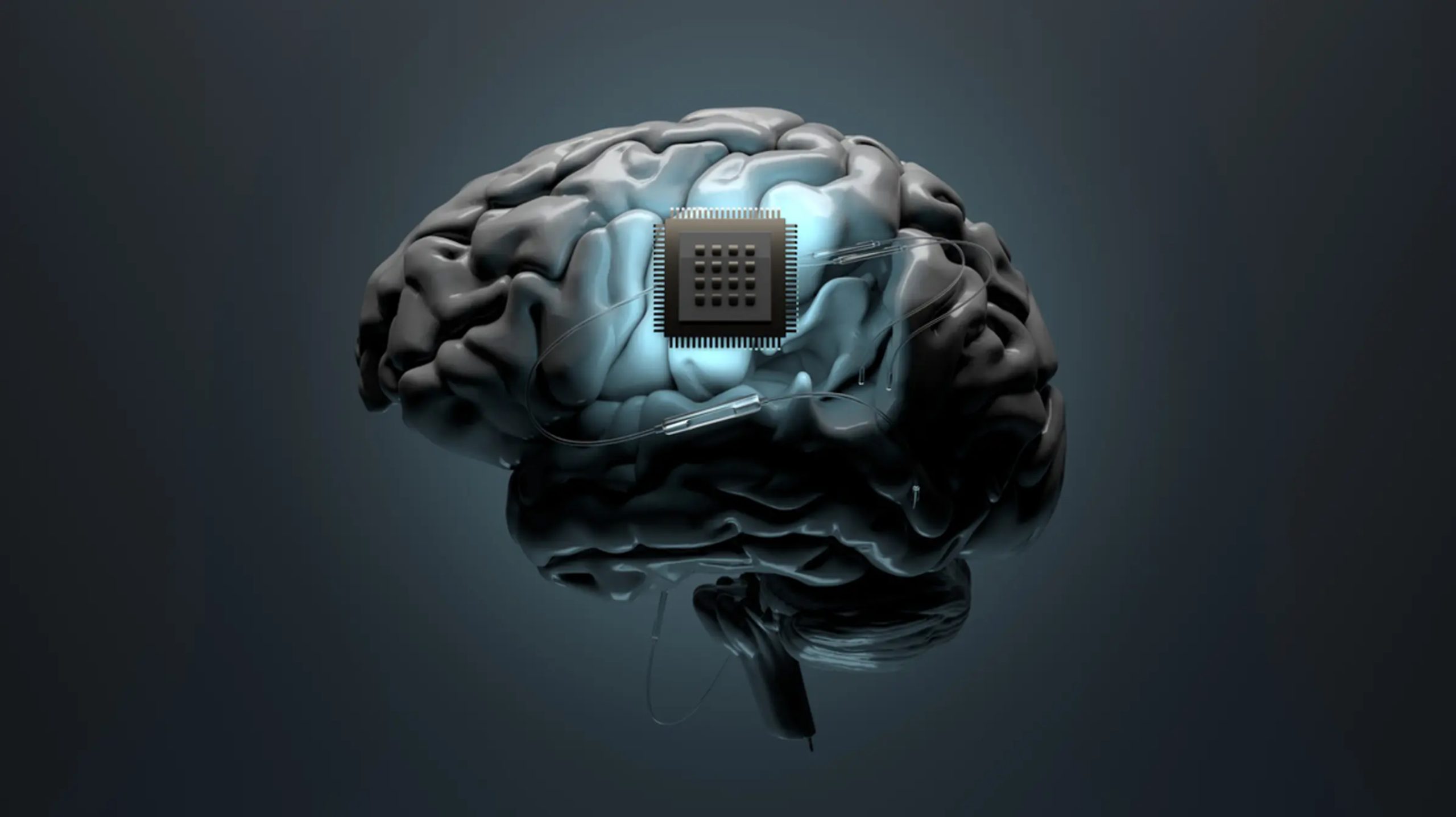 Synchron Implanta Su Primer Chip Cerebral En Estados Unidos