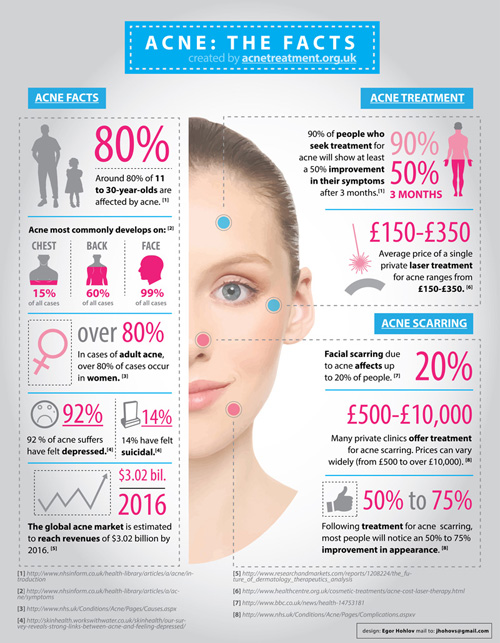 Acne The Facts Infographic Infographic List