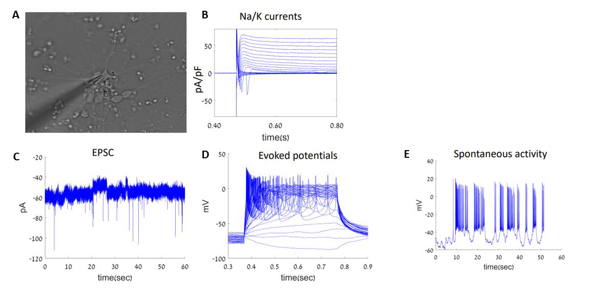 Human Motor Neurons Ipsc Derived Normal Ixcells