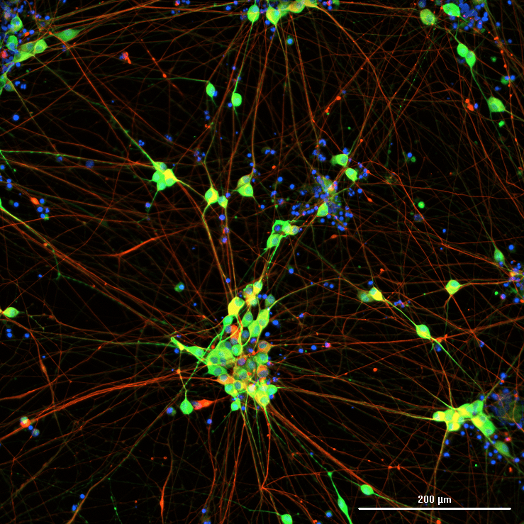 Human Sensory Neurons Ipsc Derived Normal Ixcells