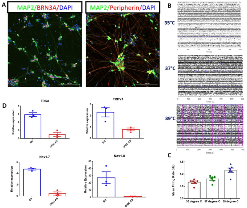 Human Sensory Neurons Ipsc Derived Normal Ixcells