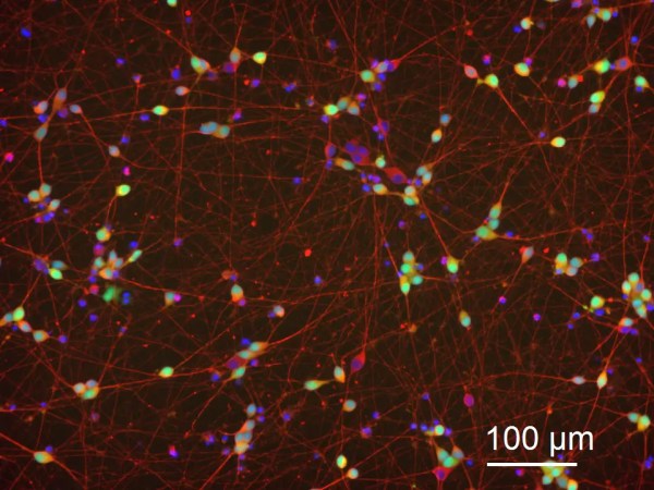 Human Glutamatergic Neurons Ipsc Derived Gfp Labeled Normal Ixcells