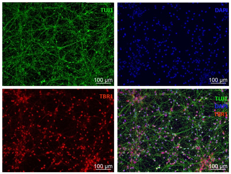 Human Cortical Neurons Ipsc Derived Normal Ixcells