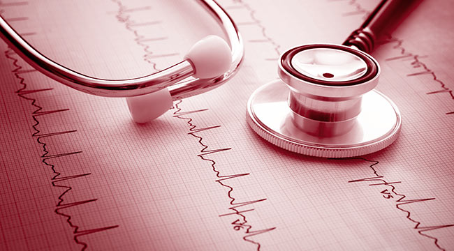 Eletrocardiograma Ecg O Que é Para Que Serve E Como é Feito O Exame