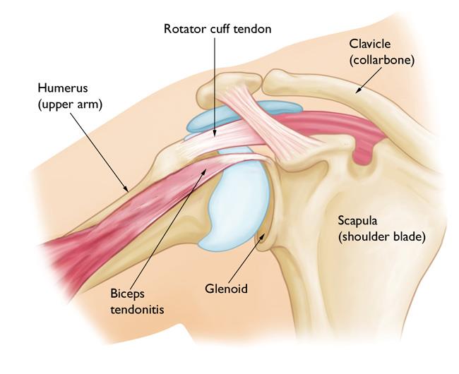 Long Head Of Biceps Pathology At Shoulder Adam Watson Orthopaedic