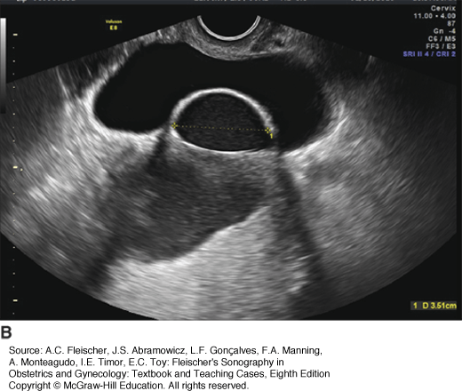 Ultrasound Evaluation In The Modern Labor Delivery Unit An Important