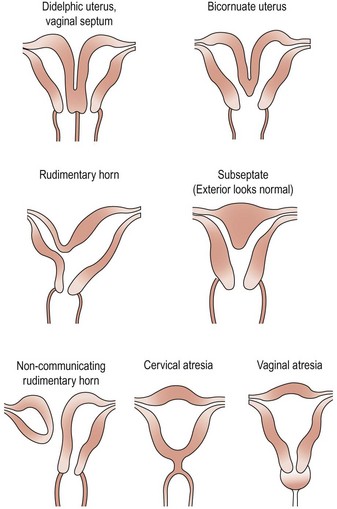 Sexual Differentiation Normal And Abnormal Obgyn Key