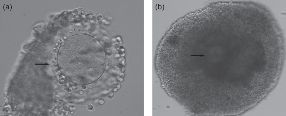 Chapter 25 Ovarian Tissue Cryopreservation Obgyn Key