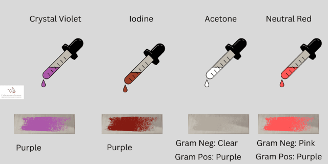 Gram Stain Purpose Principle Procedure Complete Guide