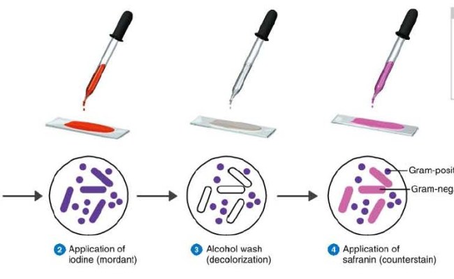 Gram Staining Principle Procedure Interpretation