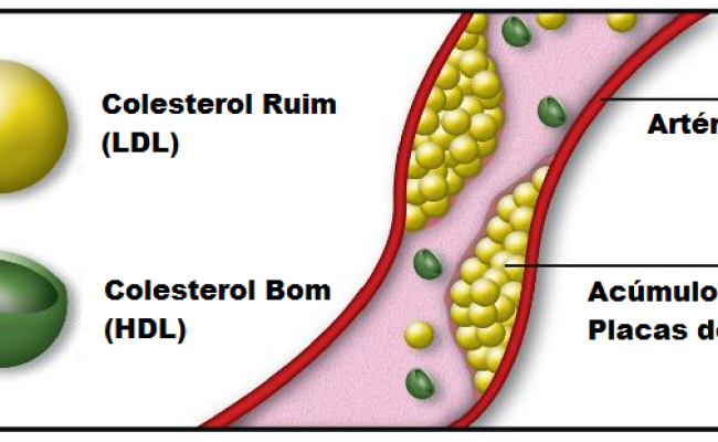 Conheca A Diferenca Entre Colesterol Bom E Ruim Otosection