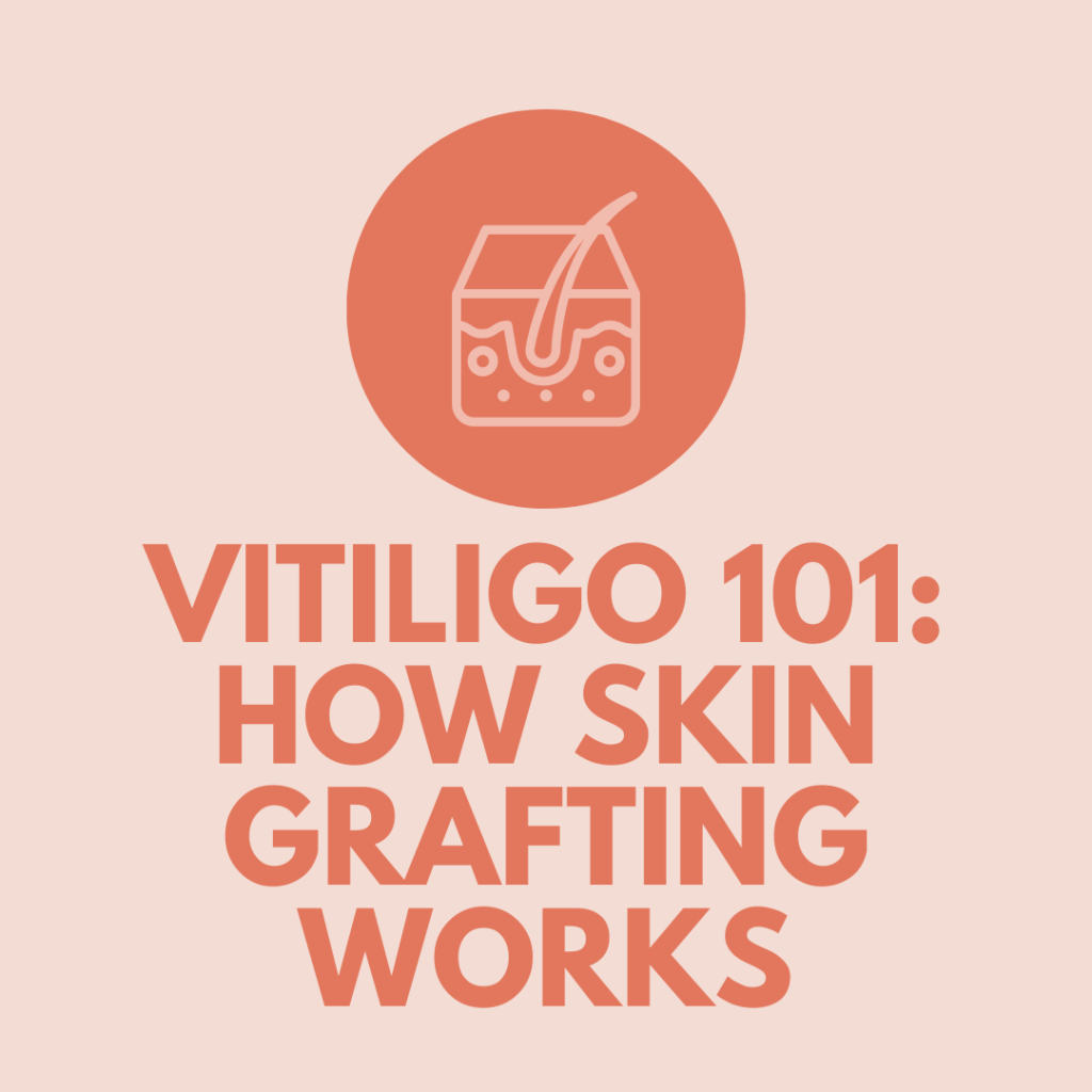 5 Types Of Vitiligo And What They Mean Living Dappled