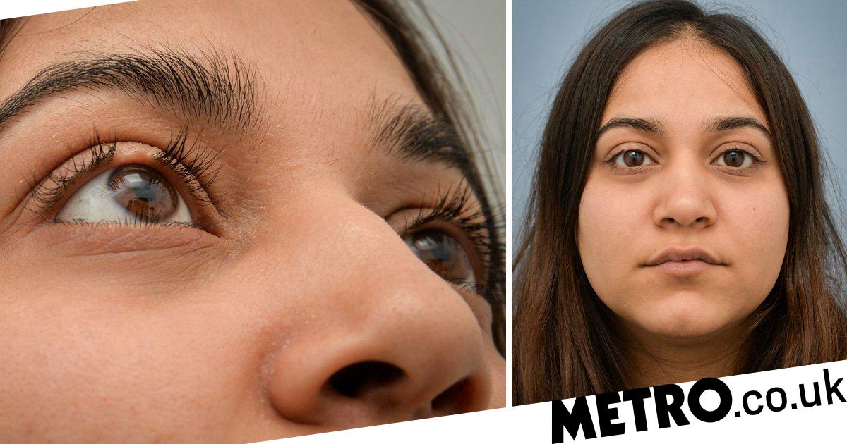 Woman Who Ripped Her Eyelid Open On A Nightout Has An Eyelash