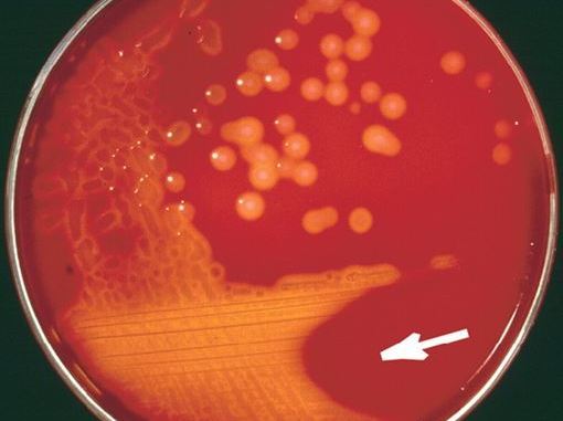 Streptococcus Pyogenes Gas Characteristics Virulence Factors