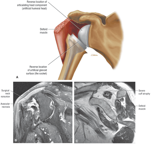 The Shoulder Musculoskeletal Key