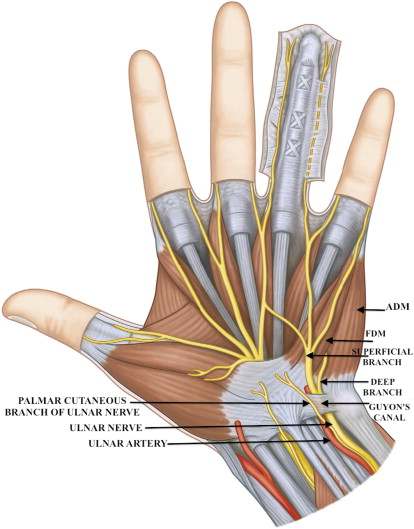 Ulnar Nerve Cubital Tunnel Syndrome