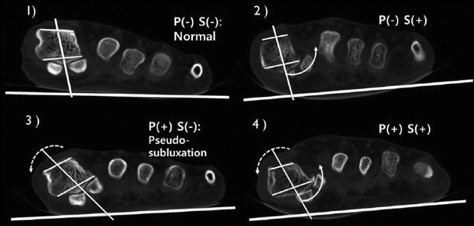 Radiographic Assessment Musculoskeletal Key