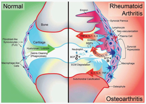 Synovium And Joint Biology Musculoskeletal Key