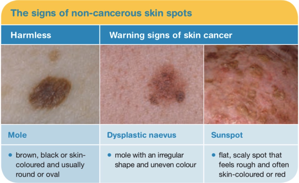 Skin Cancer The Warning Signs Au