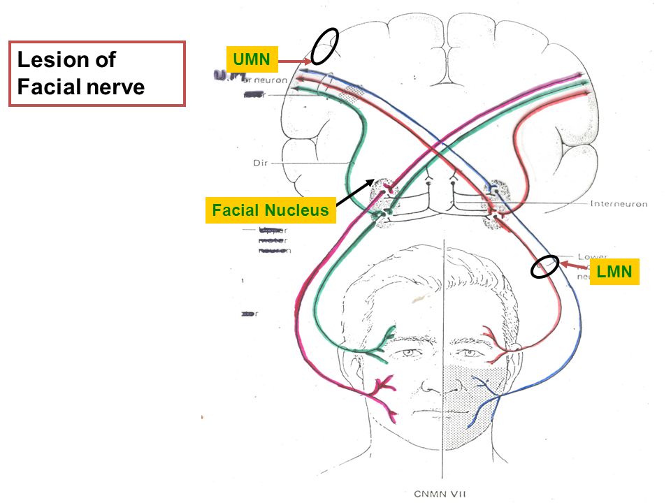 Cranial Nerve 7 Facial Nerve And Its Pathology