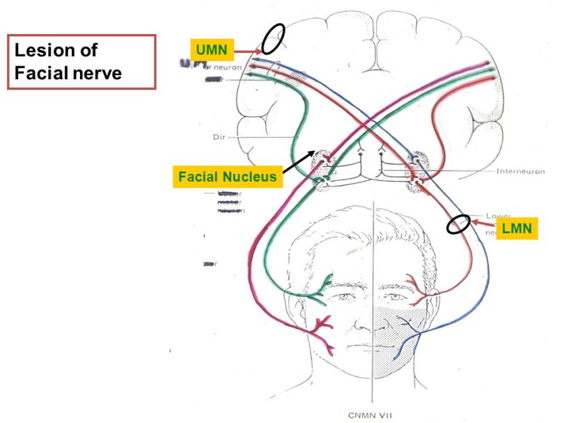 Cranial Nerve 7 Facial Nerve And Its Pathology